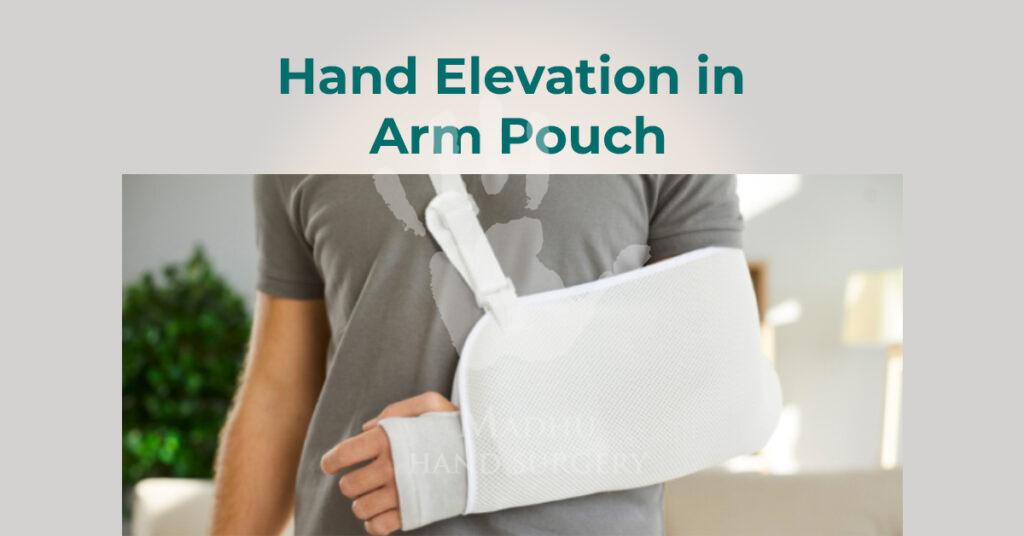 The Best Ultimate Guide To Hand Elevation In Arm Pouch!